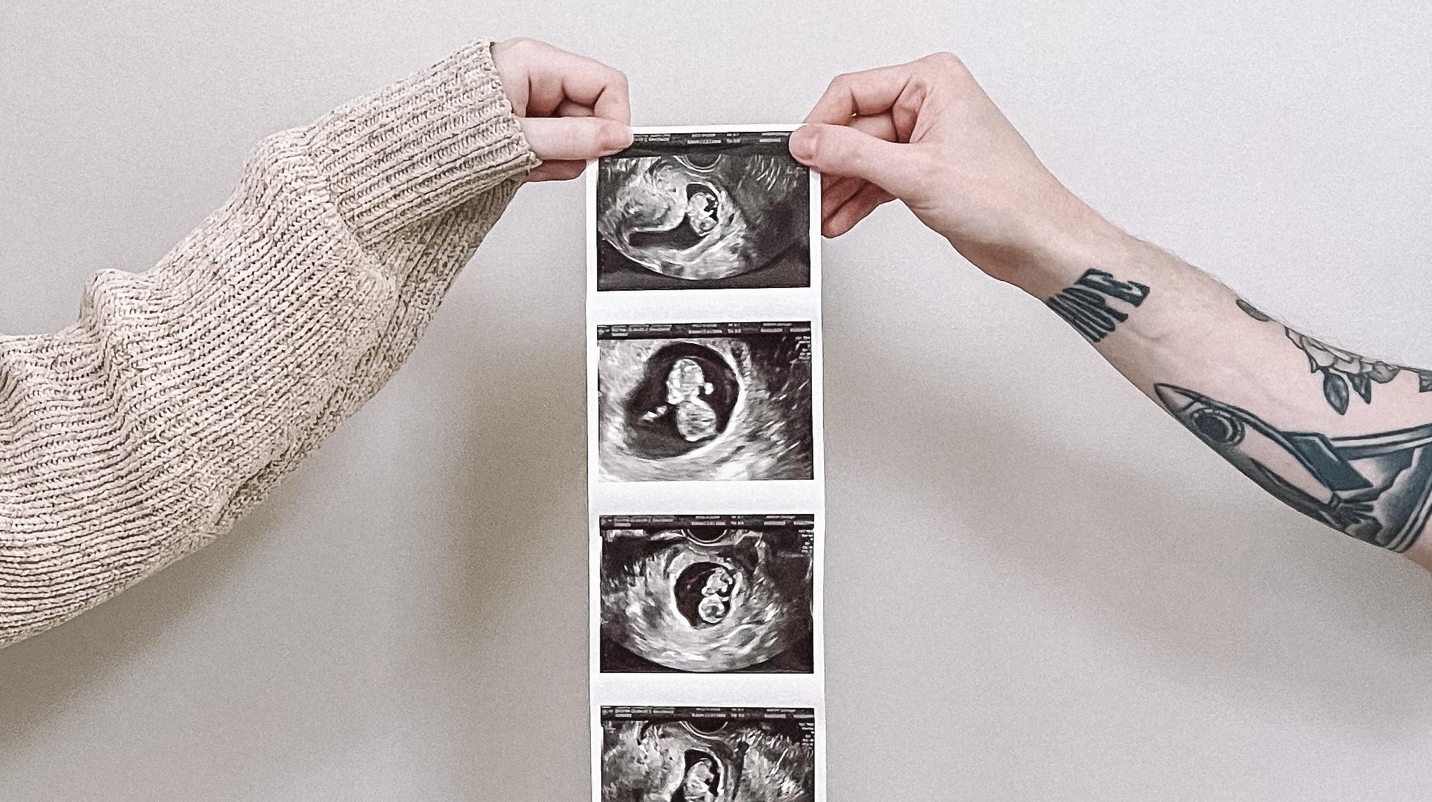 Samantha Cronin and Ben Cronin's Baby Registry - Zola Baby