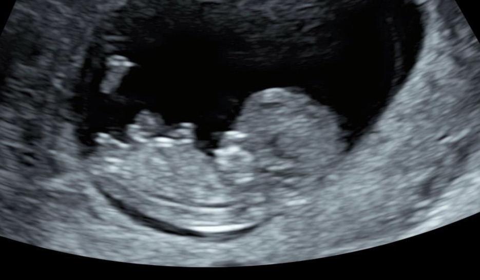 Luca Racz and Jason Racz's Wedding Website